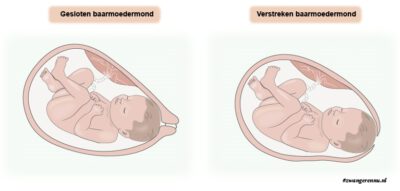De bevalling van begin tot eind | Zwanger en nu