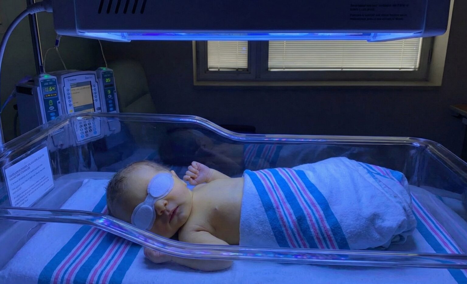 Geelzucht bij je baby: alles wat je moet weten over die gele gloed ...